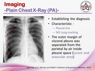 Pneumothorax PEARLS catatan kecil dokter | PDF