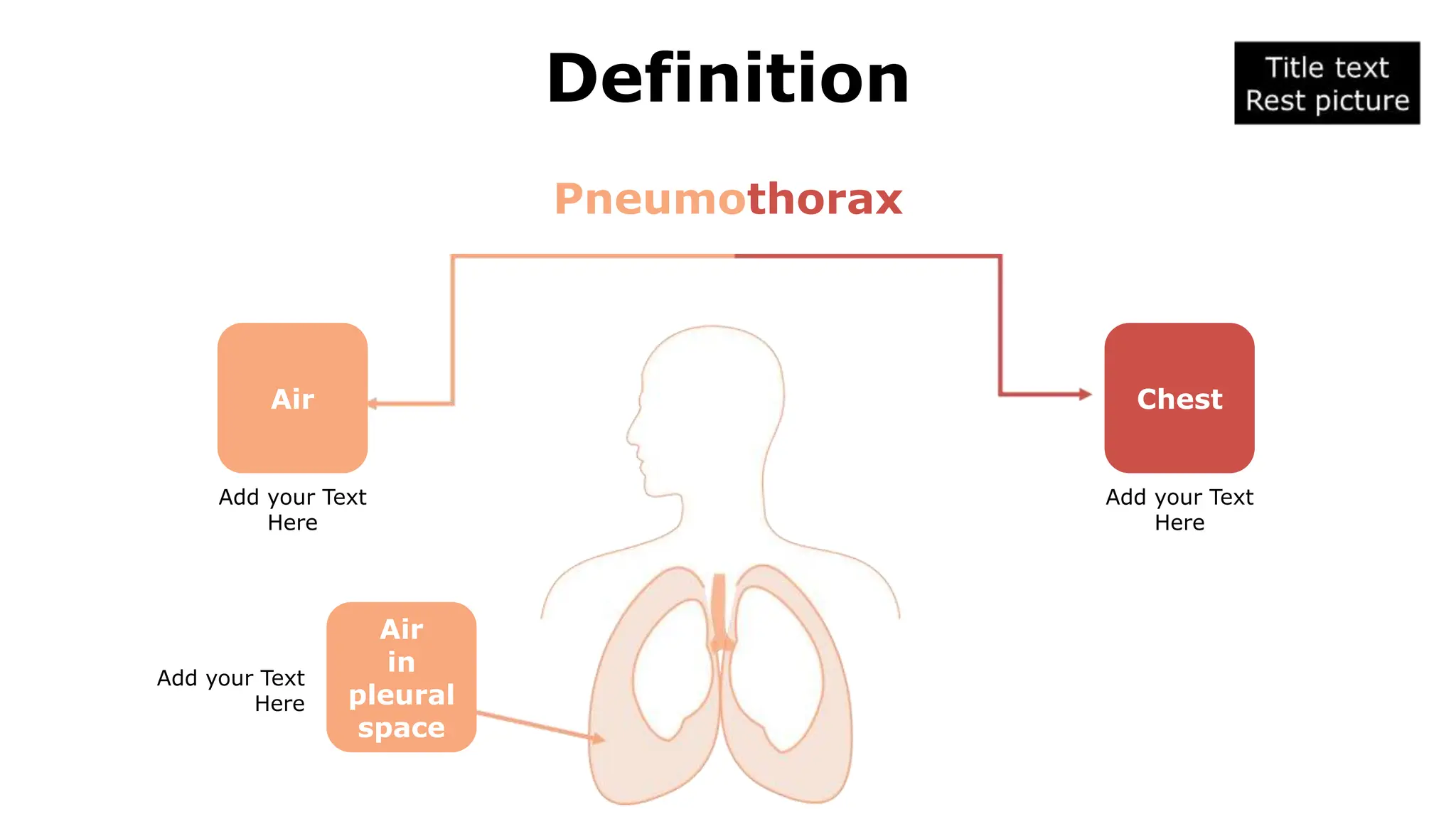 Pneumothorax PowerPoint Template.pptx