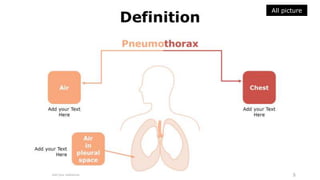 Pneumothorax PowerPoint Template.pptx