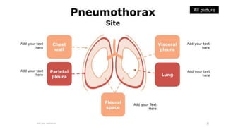 Pneumothorax PowerPoint Template.pptx
