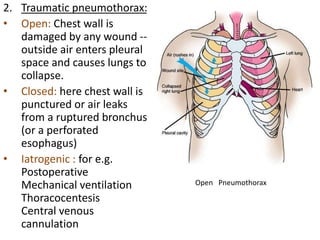 Something about PNEUMOTHORAX | PPTX