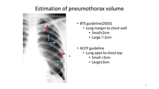Pneumothorax : Cause and management | PPTX