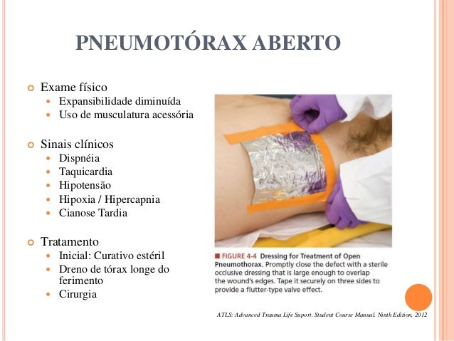 Curativo De Pneumotorax Aberto Selo De Tórax Oclusivo Projetado Para