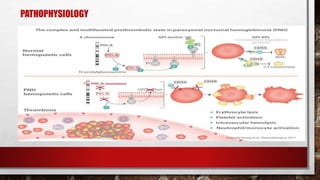 Paroxymal nocturnal hemoglobinuria | PPTX
