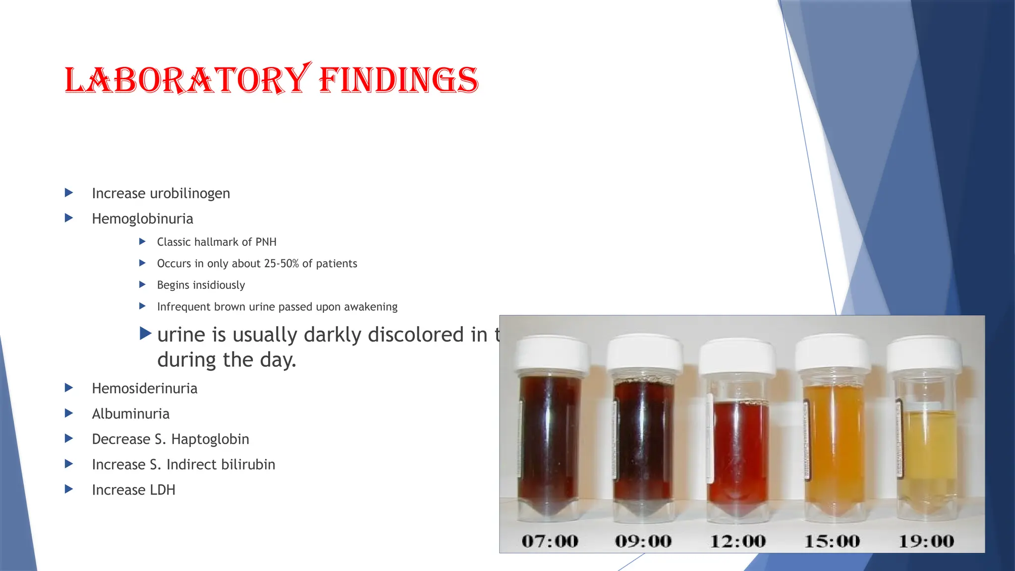 Paroxysmol Nocturnal Hemoglobinuria.pptx