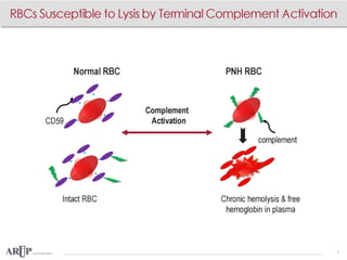Paroxysmal Nocturnal Hemoglobinuria hematology aspect | PPT