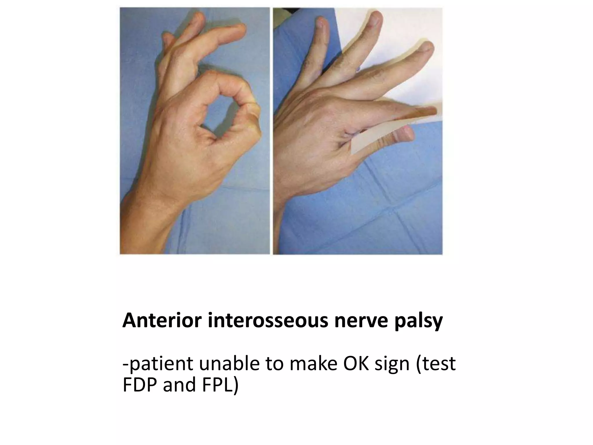 Peripheral nerve injuries | PPTX