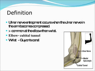 ulnar Entrapment Neuropathy and double crush syndrome | PPT