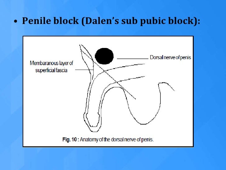 Pnr pediatric regional