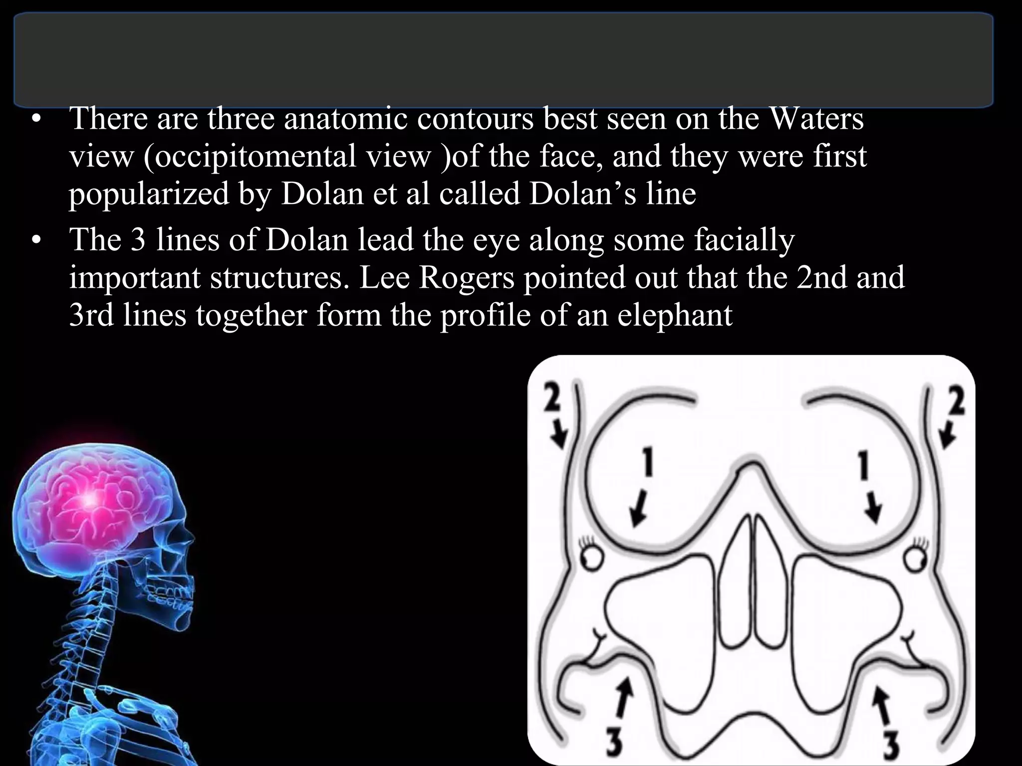 Pns view | PPT
