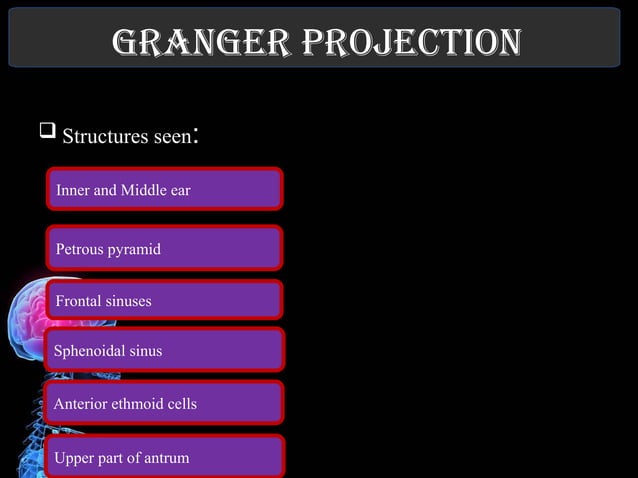 Pns view | PPT | Death, Injury, or Military Conflict | Sensitive Topics