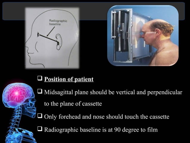 Pns view | PPT | Death, Injury, or Military Conflict | Sensitive Topics