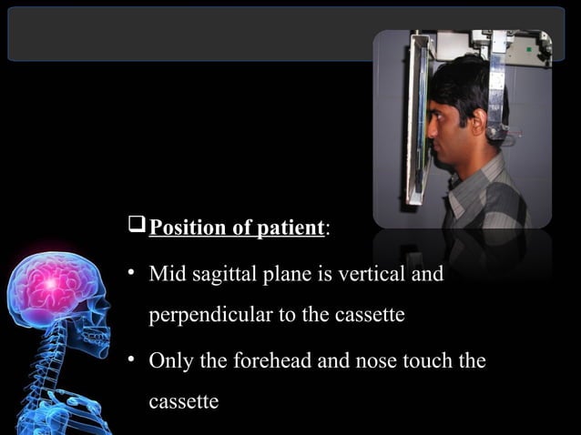 Pns view | PPT | Death, Injury, or Military Conflict | Sensitive Topics