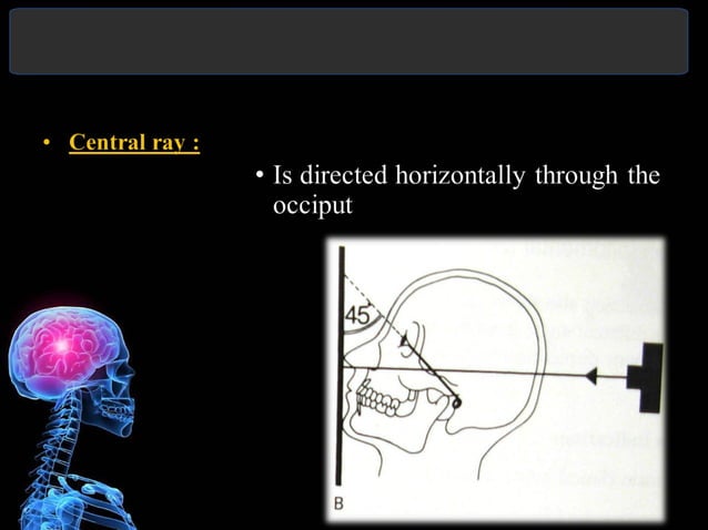 Pns view | PPT | Death, Injury, or Military Conflict | Sensitive Topics