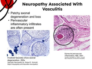 PNS-AND-SKELETAL-MUSCLES.please do not forget .pdf