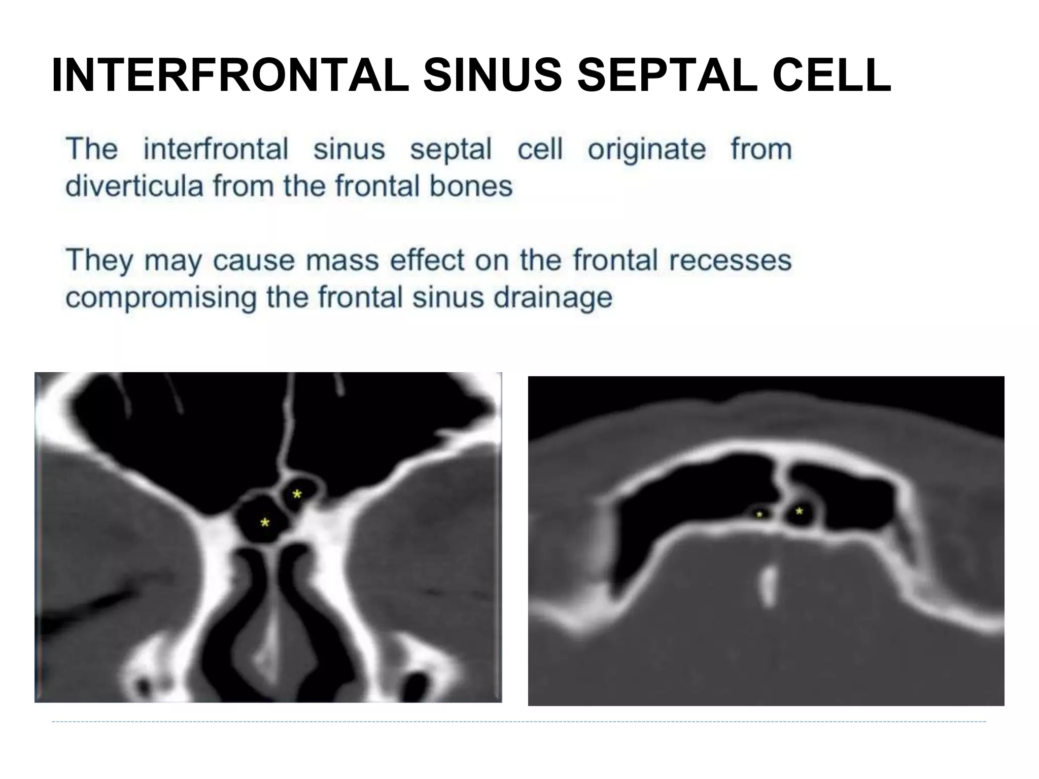PNS- radiological anatomy (wecompress.com) (1).pptx
