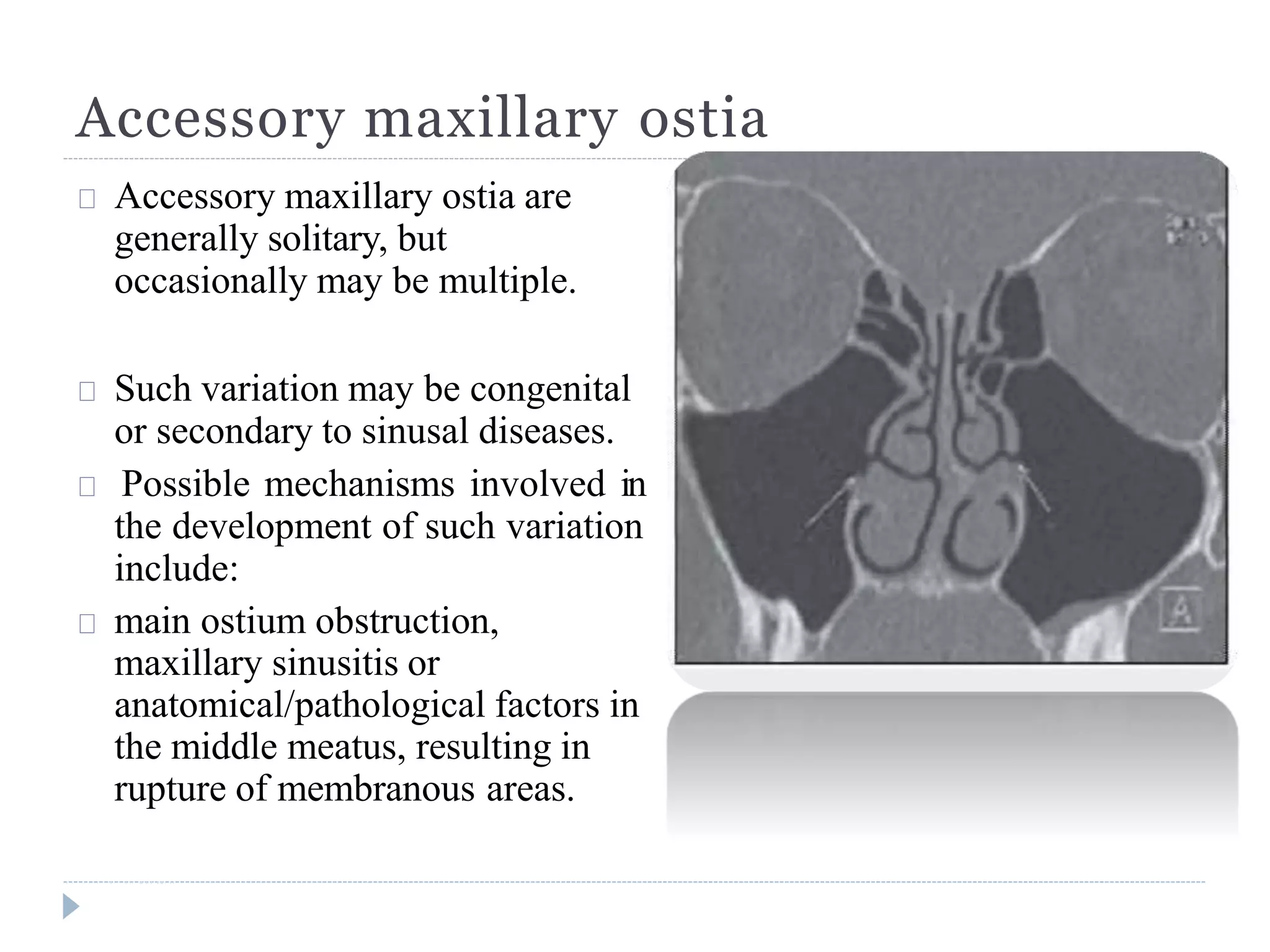 PNS- radiological anatomy (wecompress.com) (1).pptx