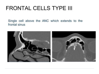 PNS- radiological anatomy (wecompress.com) (1).pptx