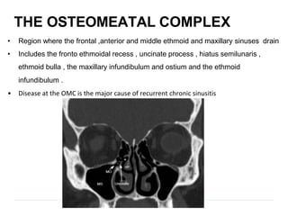 PNS- radiological anatomy (wecompress.com) (1).pptx