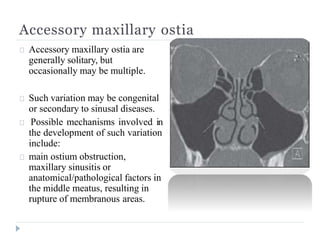 PNS- radiological anatomy (wecompress.com) (1).pptx
