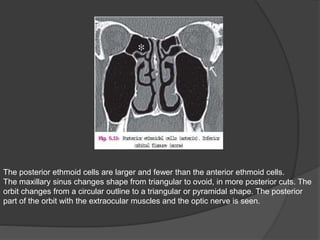 PNS (Para-nasal-sinuses) anatomy and variants | PPTX