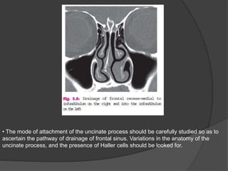PNS (Para-nasal-sinuses) anatomy and variants | PPTX