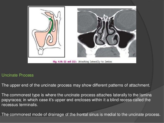 PNS (Para-nasal-sinuses) anatomy and variants