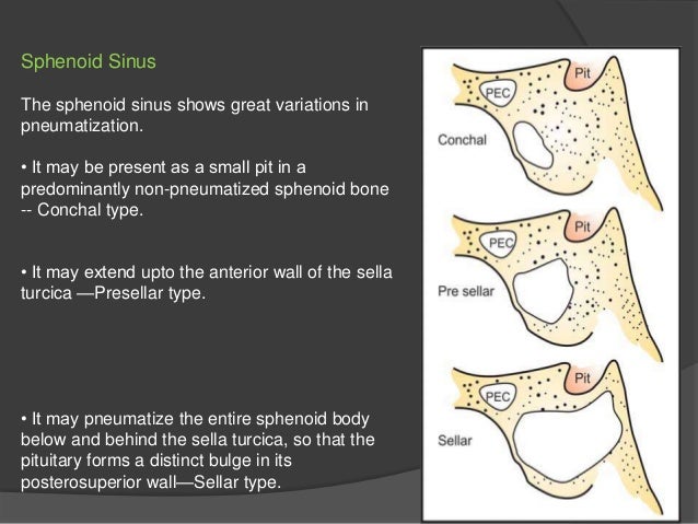 PNS (Para-nasal-sinuses) anatomy and variants