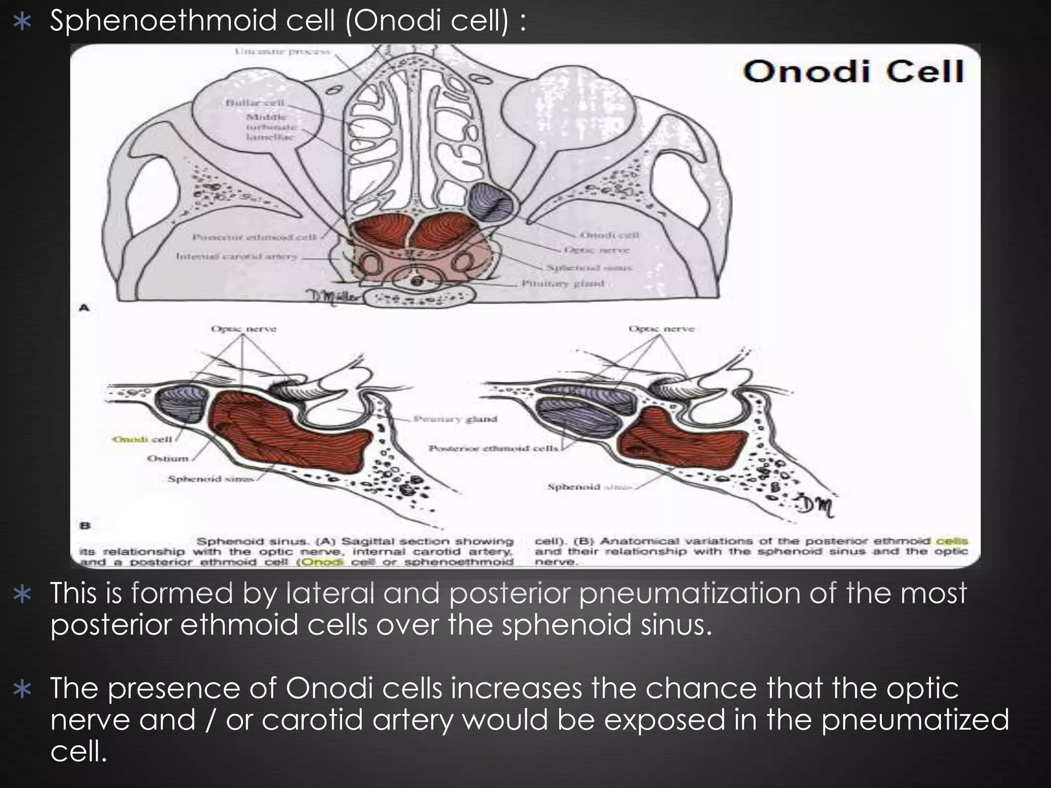 ANATOMICAL VARIANTS OF CT PNS | PPTX