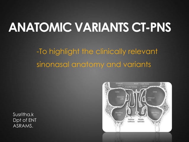 ANATOMICAL VARIANTS OF CT PNS | PPTX