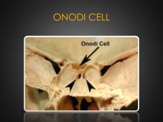 ANATOMICAL VARIANTS OF CT PNS | PPTX
