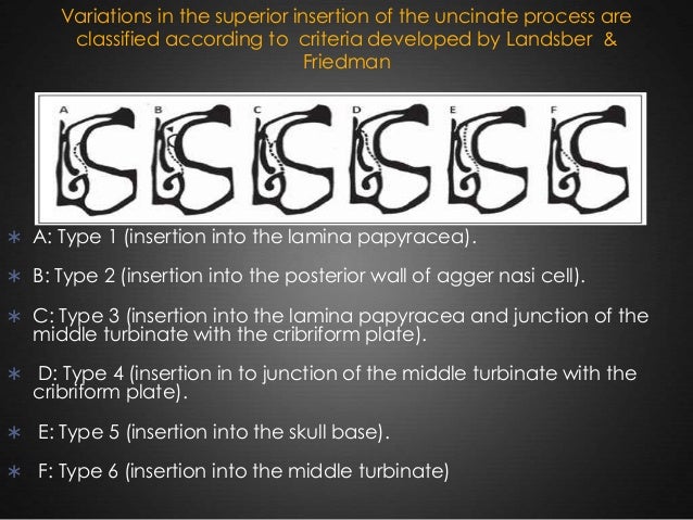 ANATOMICAL VARIANTS OF CT PNS
