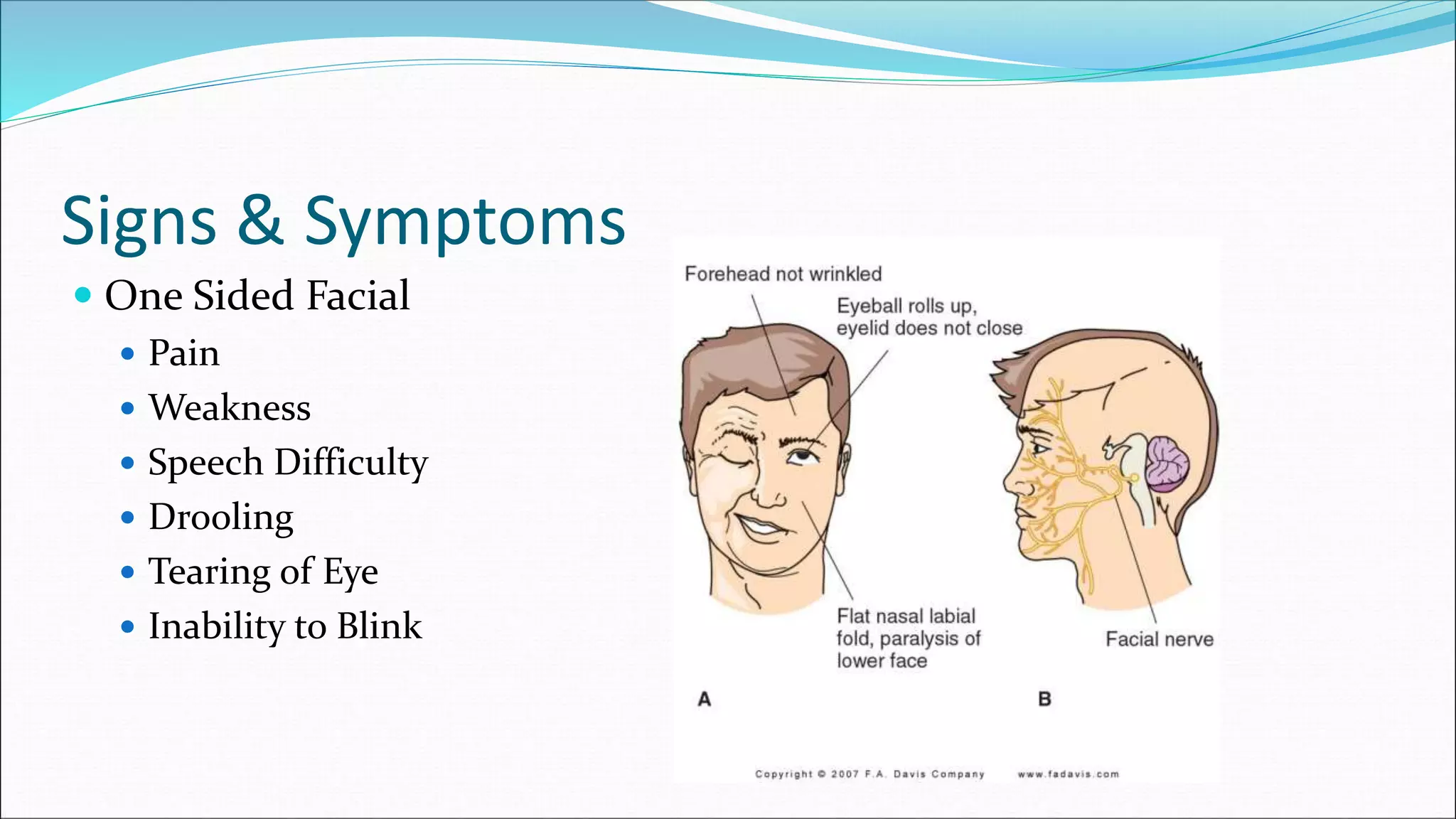PNS disorders Nursing.pptx