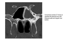 PNS INFLAMMATION.pptx