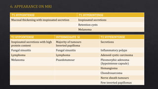 Radiological approach to PNS (Paranasal sinus) Masses | PPTX
