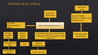 Radiological approach to PNS (Paranasal sinus) Masses | PPTX