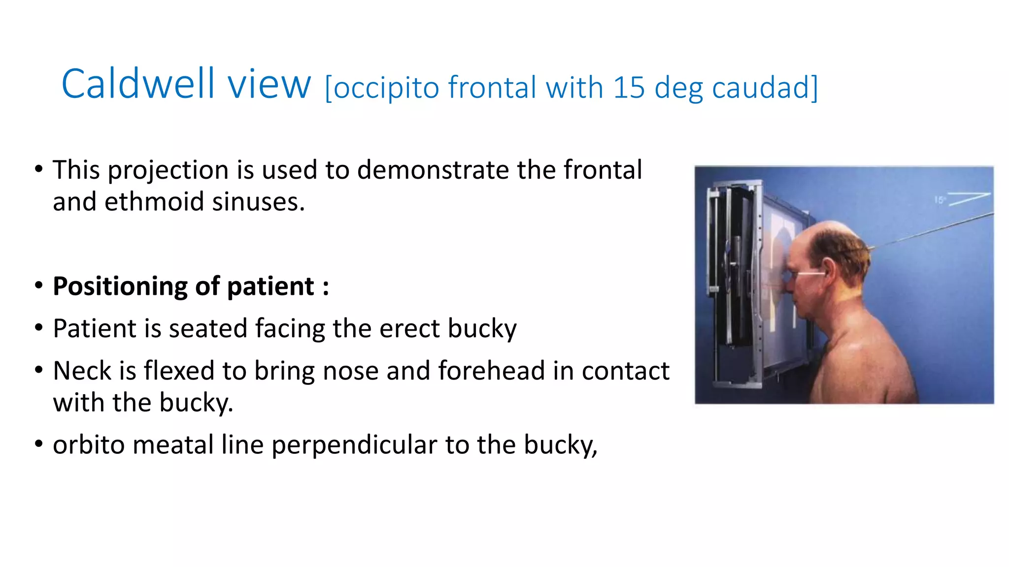 Anatomy and Xray of PNS and orbit | PPTX