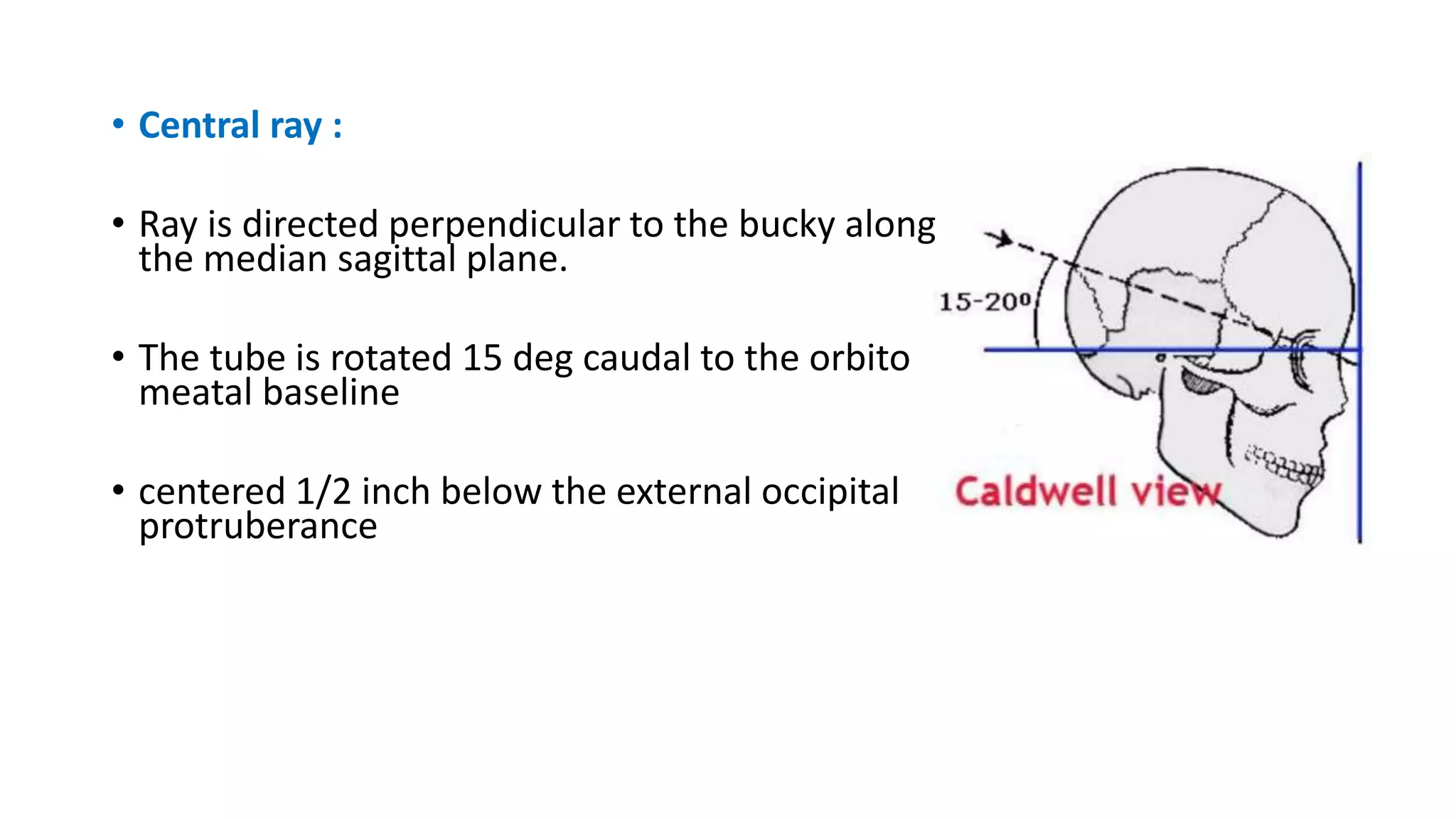 Anatomy and Xray of PNS and orbit | PPTX