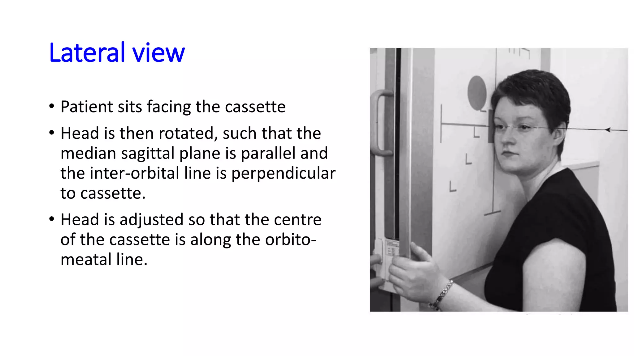 Anatomy and Xray of PNS and orbit | PPTX