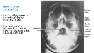 Anatomy and Xray of PNS and orbit | PPTX