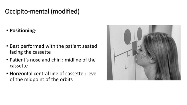 Anatomy and Xray of PNS and orbit | PPTX