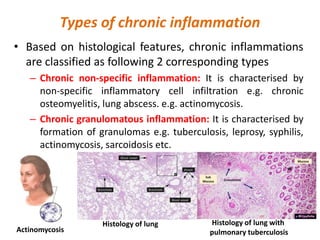 Pathophysiology inflammation and repair | PPTX