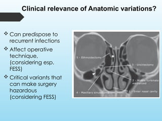 Paranasal Sinuses: Radiological Anatomy and Variants | PPTX