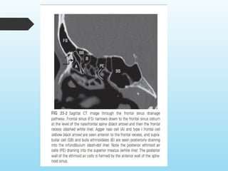 Paranasal Sinuses: Radiological Anatomy and Variants | PPTX