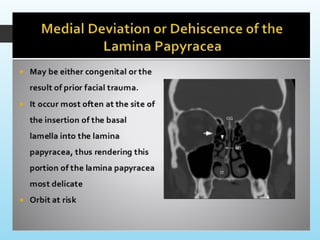 Paranasal Sinuses: Radiological Anatomy and Variants | PPTX