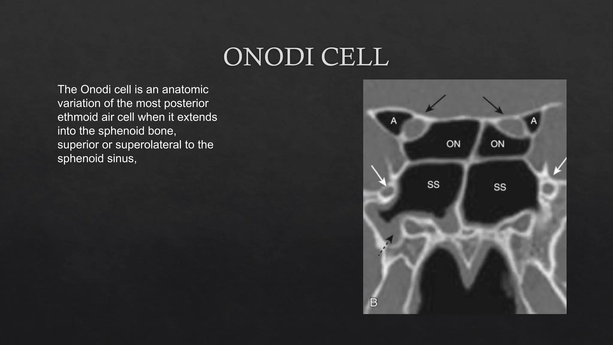 PNS RADIOLOGY AND PATTERNS POWERPOINT PPT.pptx