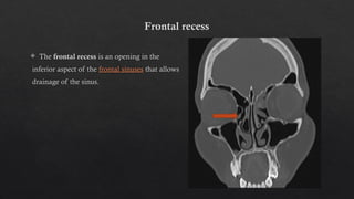 PNS RADIOLOGY AND PATTERNS POWERPOINT PPT.pptx