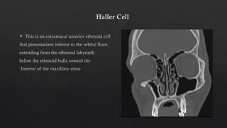 PNS RADIOLOGY AND PATTERNS POWERPOINT PPT.pptx