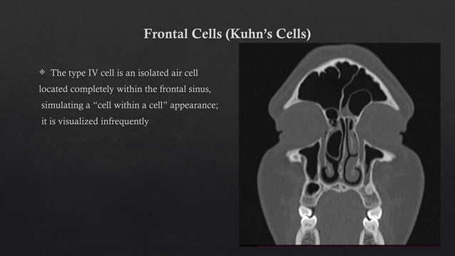 PNS RADIOLOGY AND PATTERNS POWERPOINT PPT.pptx