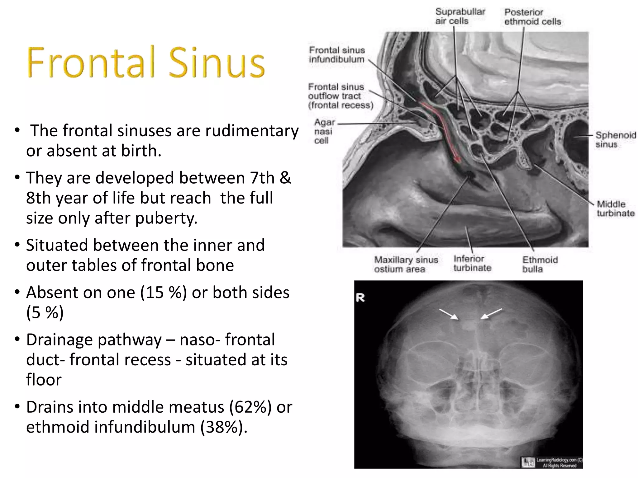 Paranasal sinus diseases and their management | PPTX